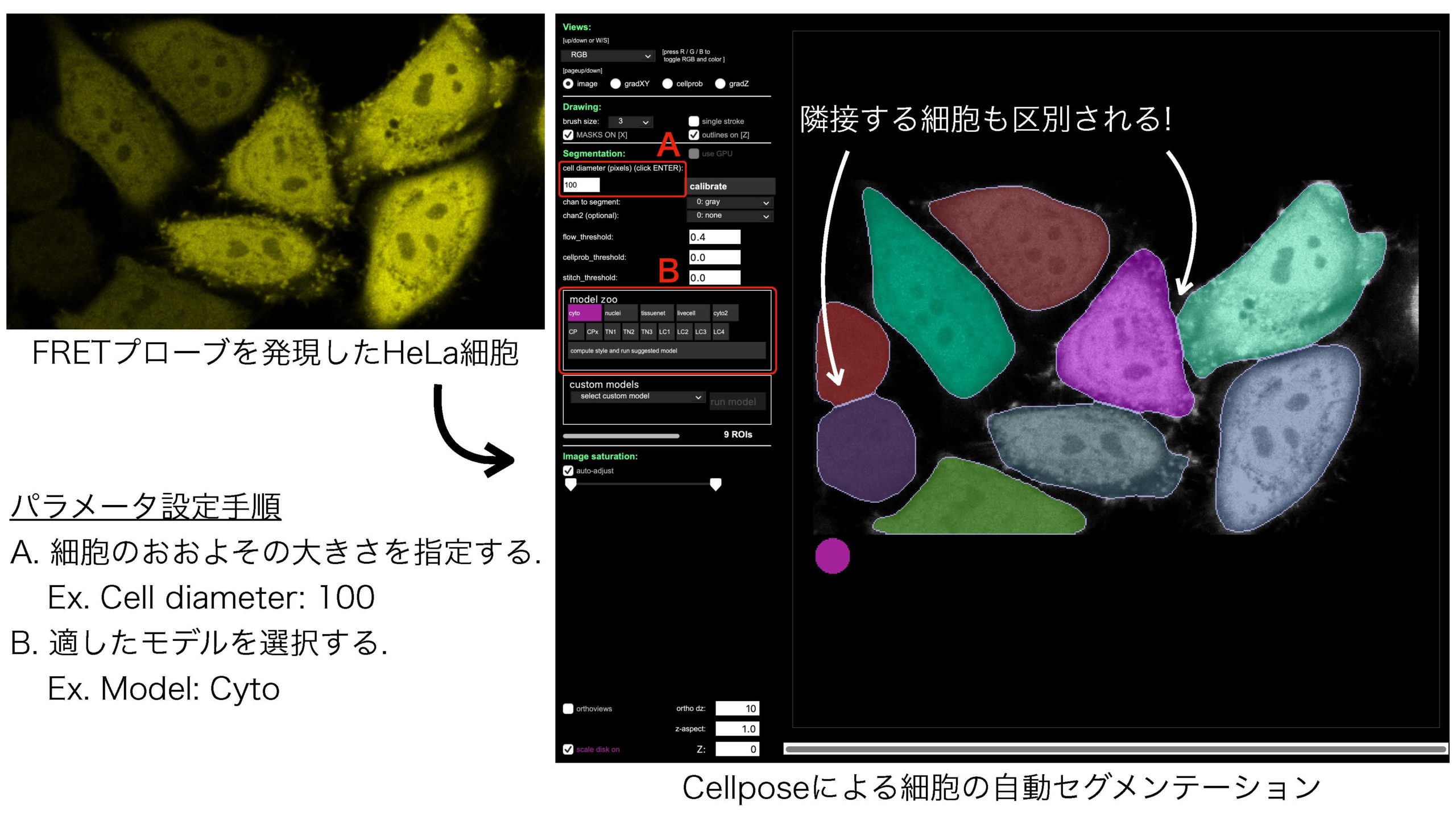 細胞自動セグメンテーションAI - 学術変革領域研究(A) 非ドメイン型バイオポリマーの生物学
